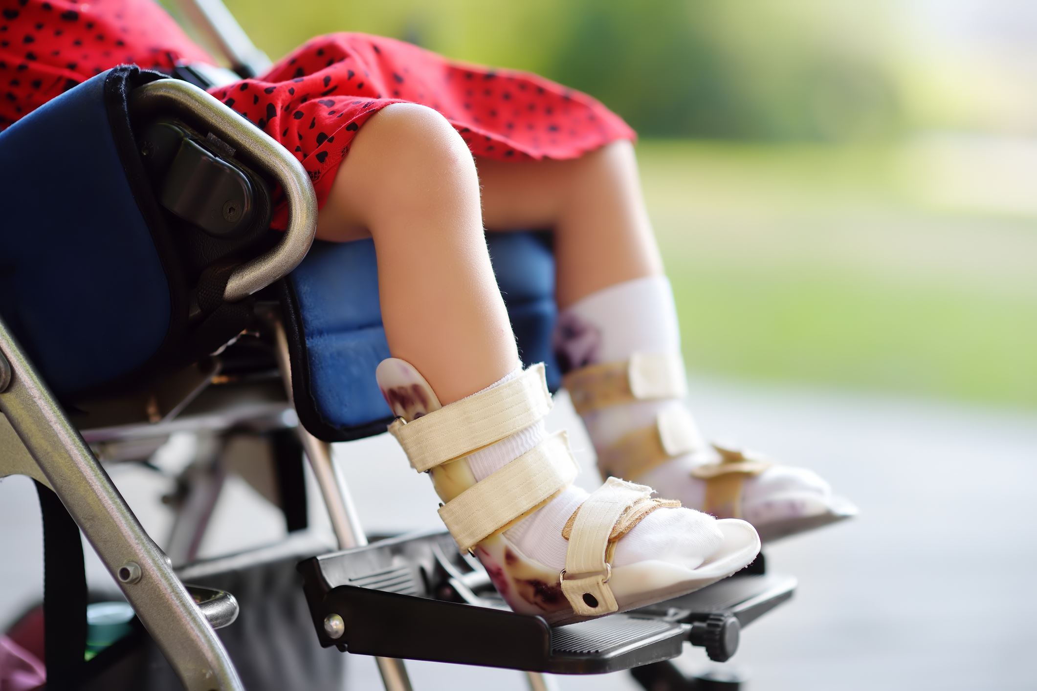 The Lifelong Costs of Cerebral Palsy