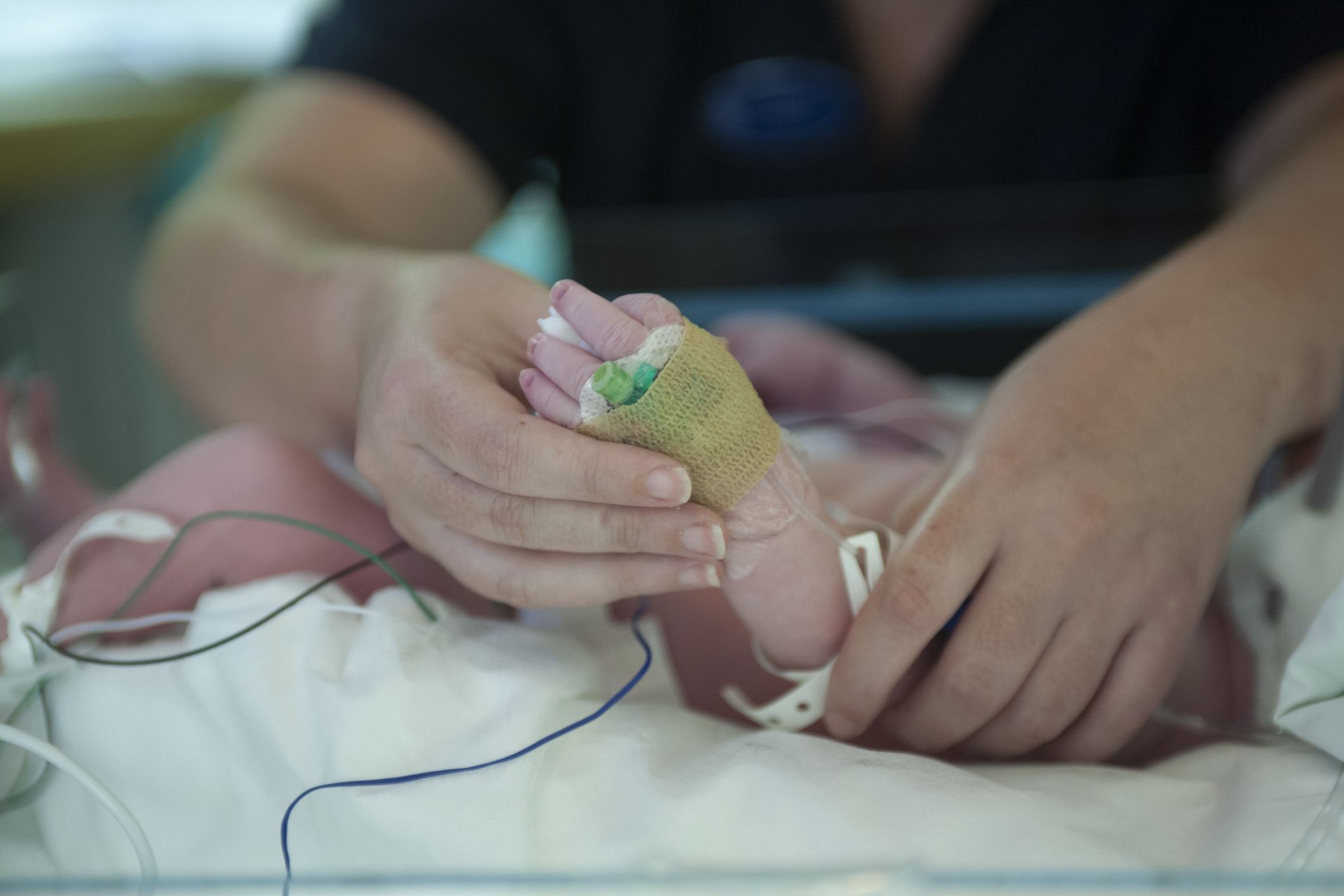 What Is the Difference Between a Birth Defect and a Birth Injury?